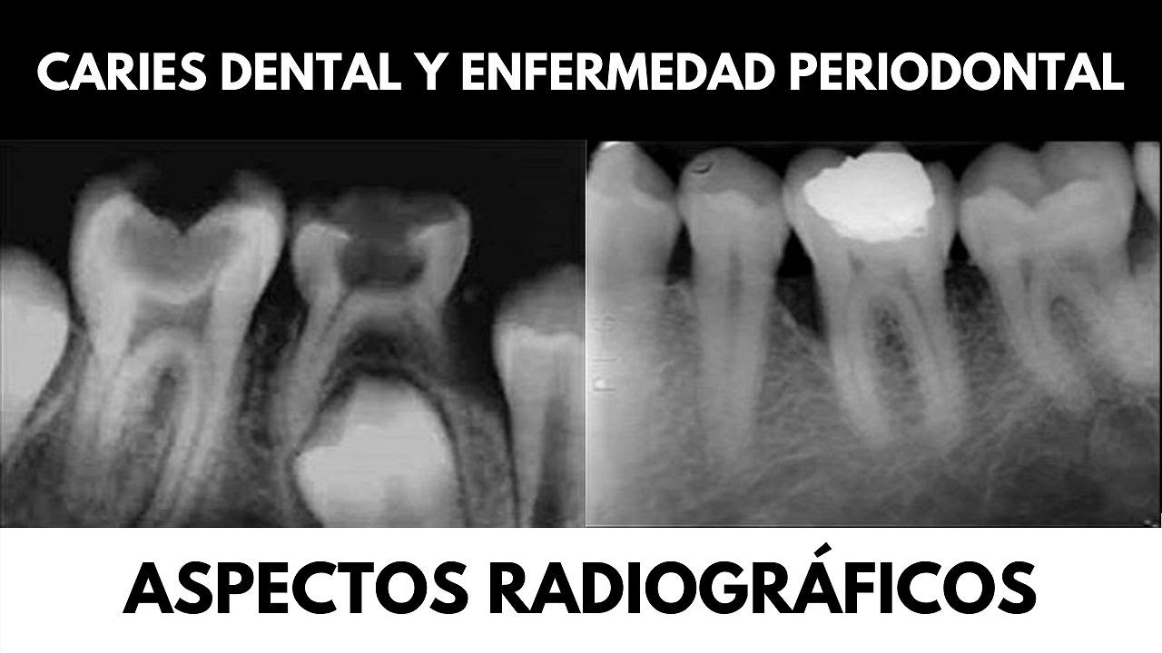 OVI Dental (@OviDentalGo) / Twitter