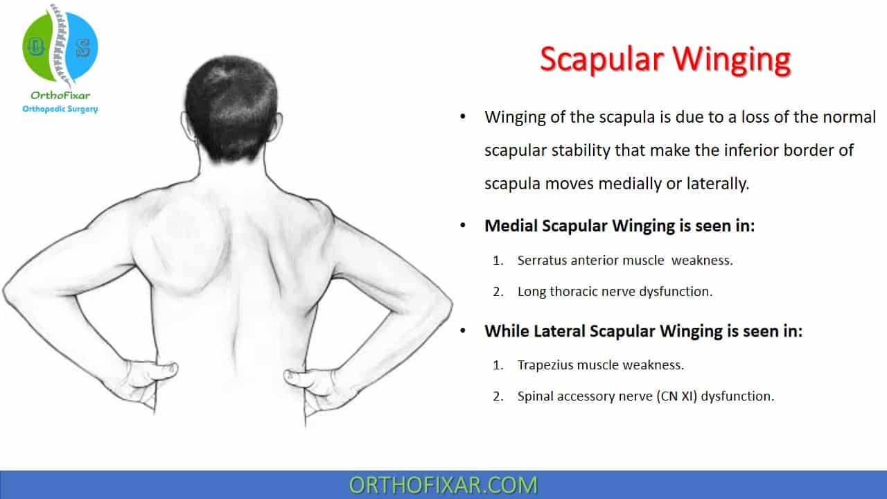 Winged Scapula Serratus Anterior