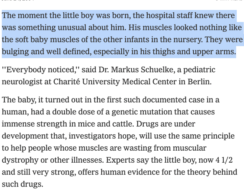 German Baby Born With Muscles