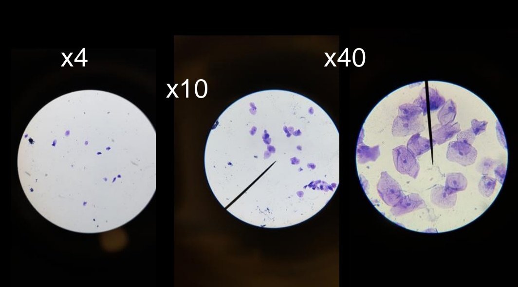 Cheek Cells Under Microscope 100x