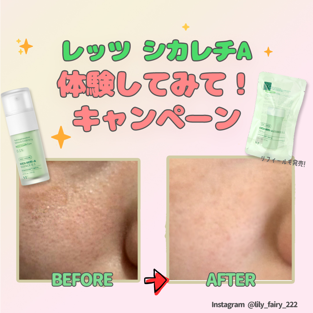 vtcosmetics_japan on Twitter: "🌿レッツ シカレチA 体験キャンペーン🌿 SNS・レビューで大話題のシカレチA 現在 #Qoo10 に再入荷されました！ #メガ割 ...