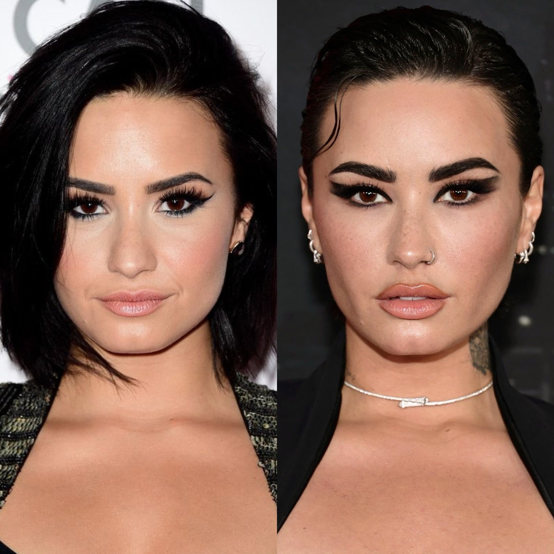 Demi Lovato Chin Surgery