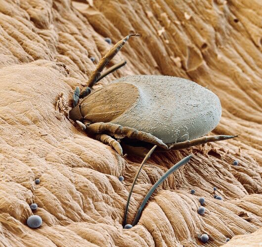 microscopic images. on Twitter: "tick feeding on human blood under an electron microscope https ...