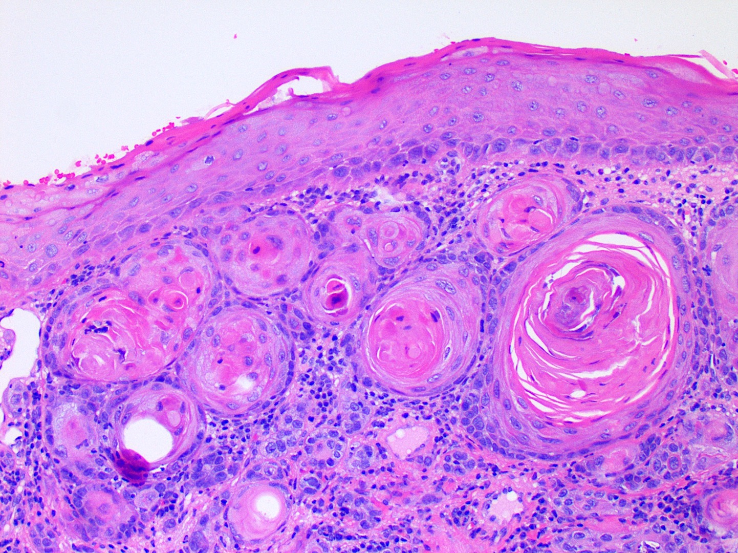 Pathology Outlines What's New At PathologyOutlines.com, 23 July 2020