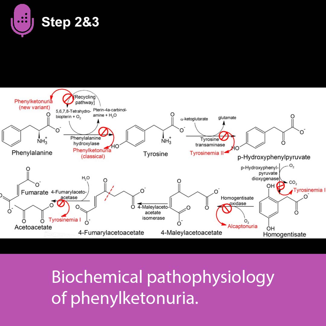 Phenylketonuria Pathway