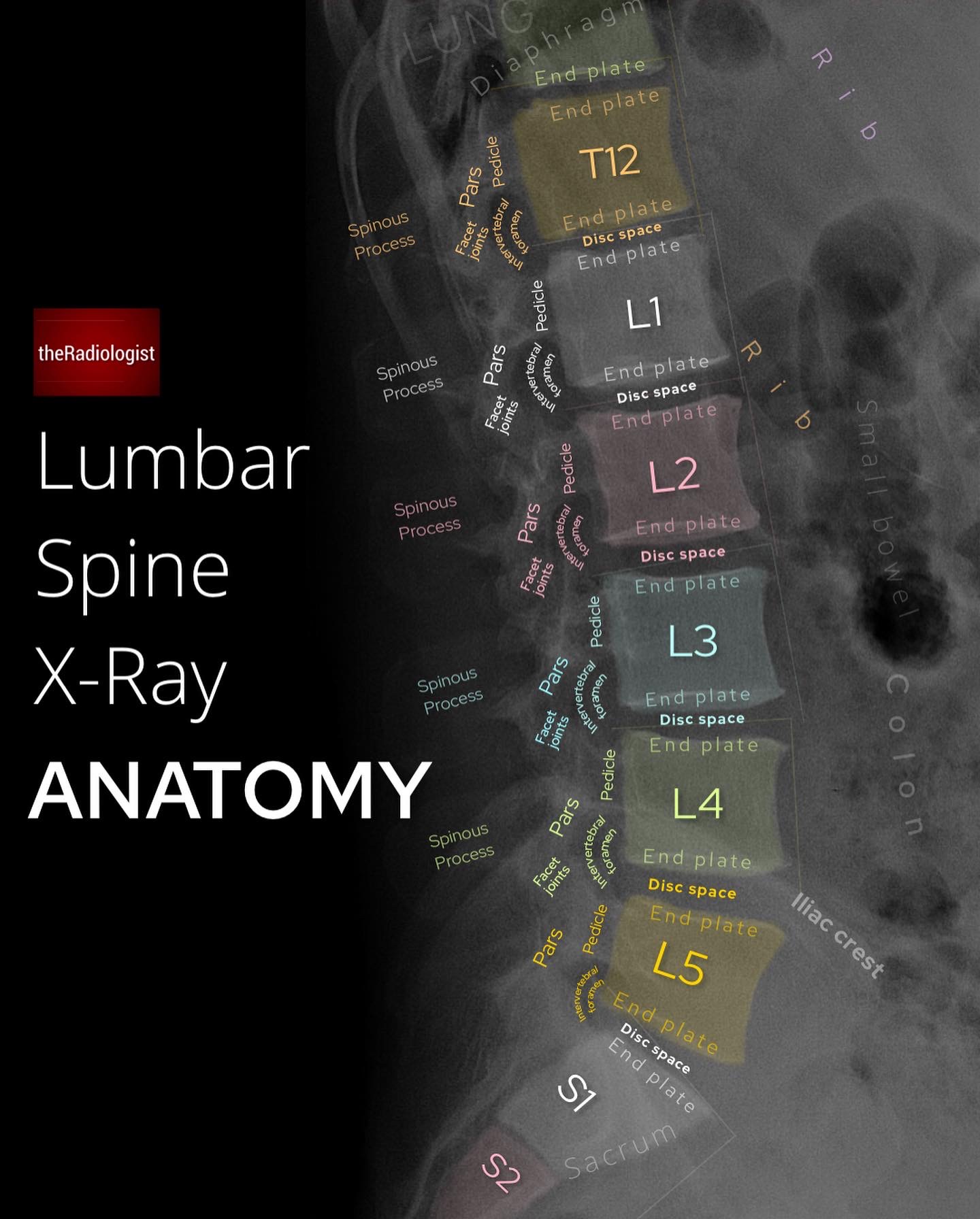 Lumbar Spine Anatomy L5