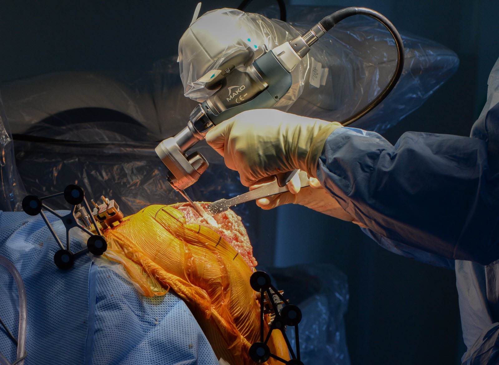 OrthoFeed on Twitter: "Stryker unveils Mako Total Knee 2.0 at the AAOS 2023 Annual Meeting https ...