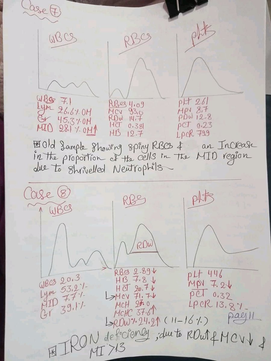 Histogram (Leukocytes and platelets and RBC) الصور للمبدعة /فاطمة سلطان ...