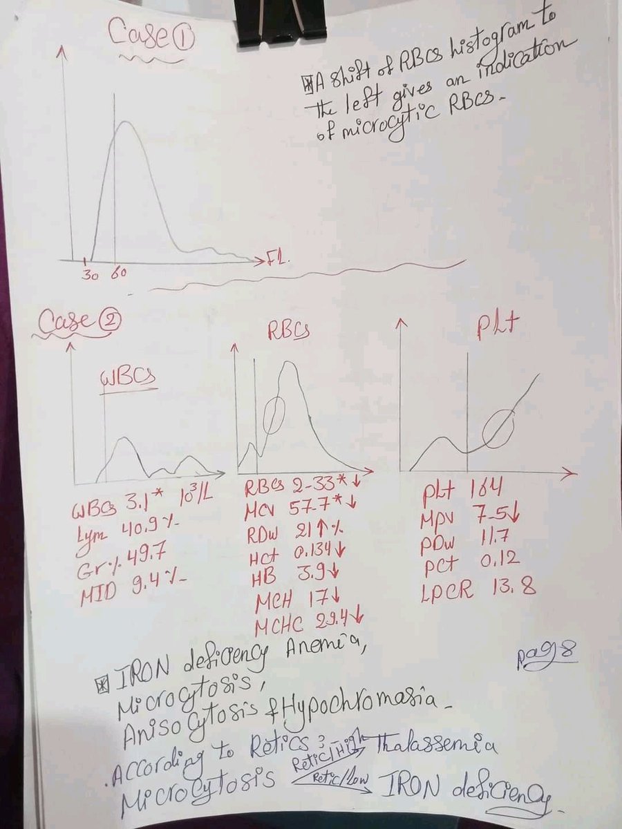 Histogram (Leukocytes and platelets and RBC) الصور للمبدعة /فاطمة سلطان ...