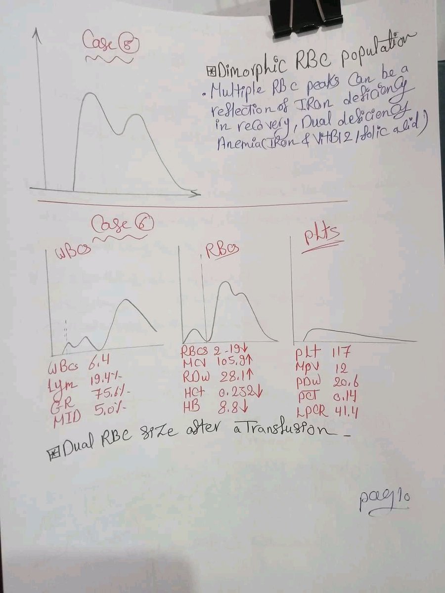Histogram (Leukocytes and platelets and RBC) الصور للمبدعة /فاطمة سلطان ...