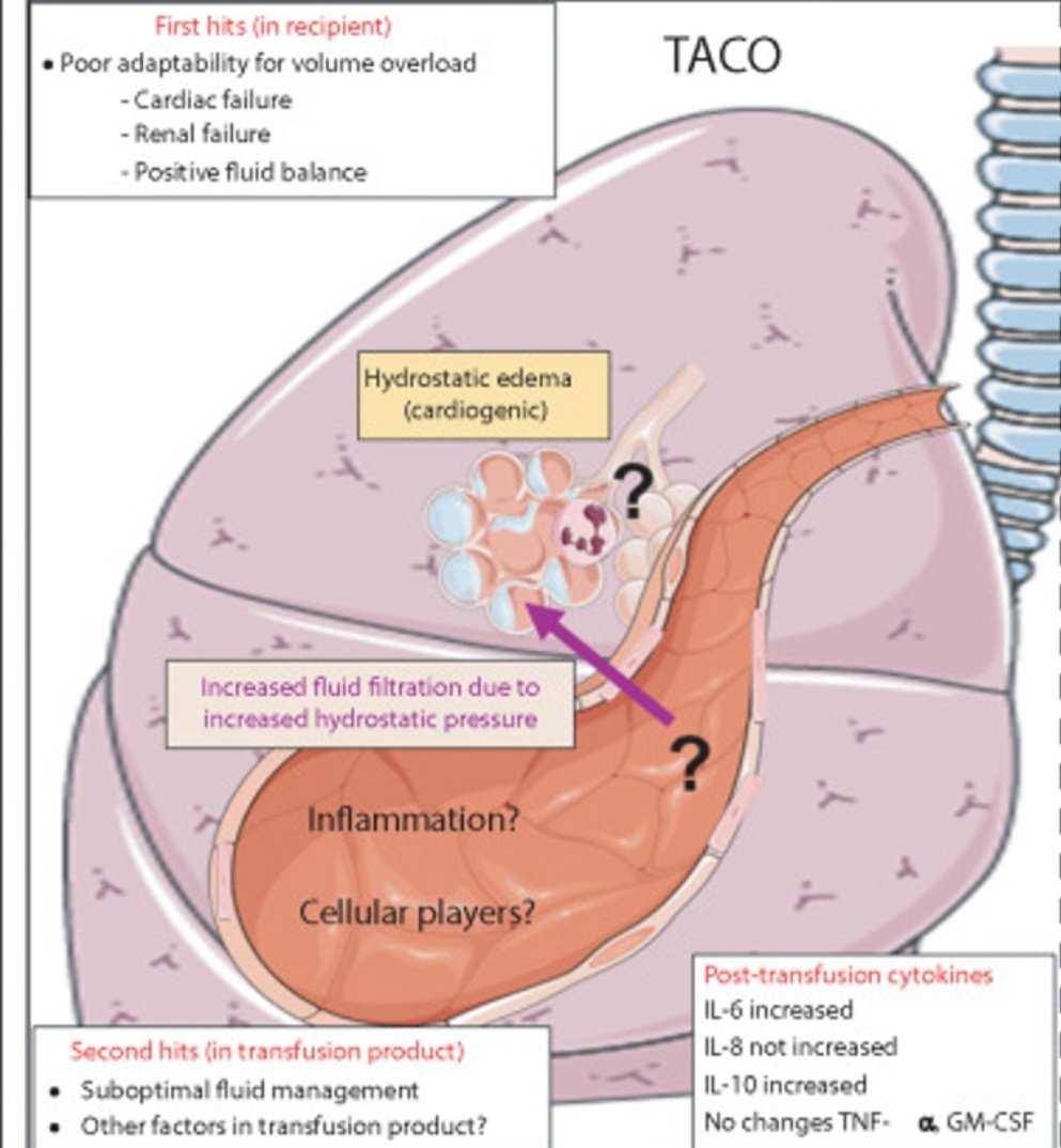 You,an ER intern transfuse a 60yr ♀ with 2 units of blood🩸 5 hrs pass ...