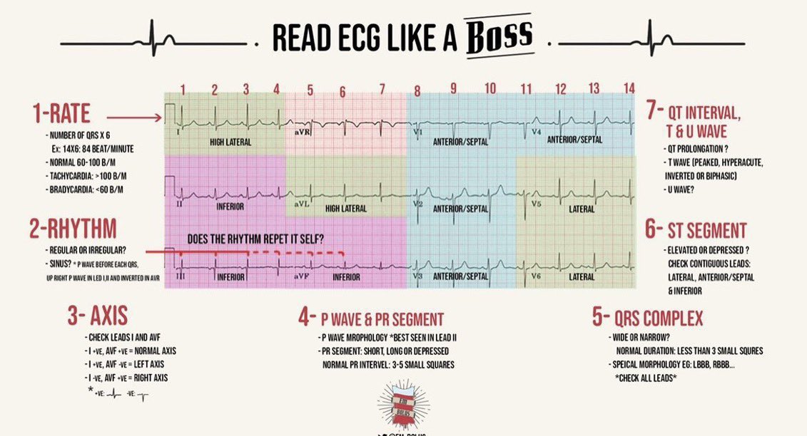 Electrocardiogram Reading