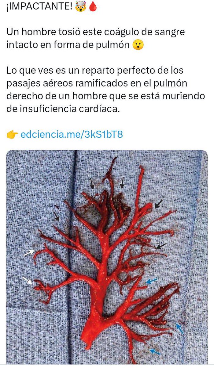 Simpsonito on Twitter: Simpsonito on Twitter: