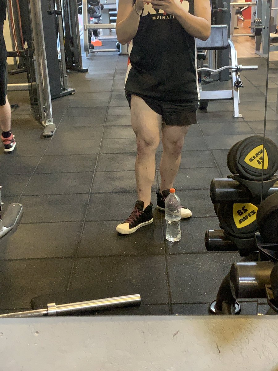 ge 🌹 on Twitter: "tenho depressao aguda"