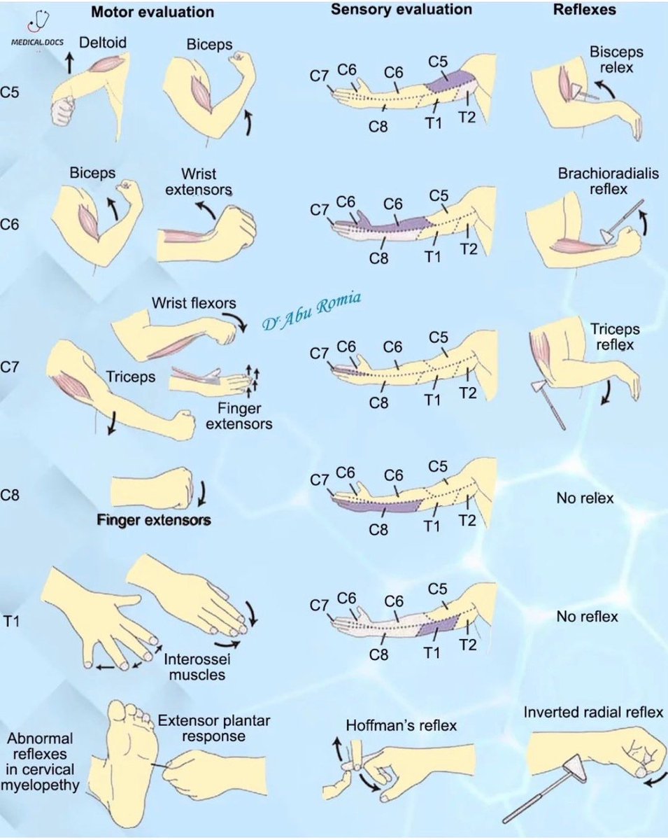 𝗥𝗲𝘀𝘂𝘀𝗠𝗲𝗱 on Twitter: "Upper Limb Neuro Assessment"