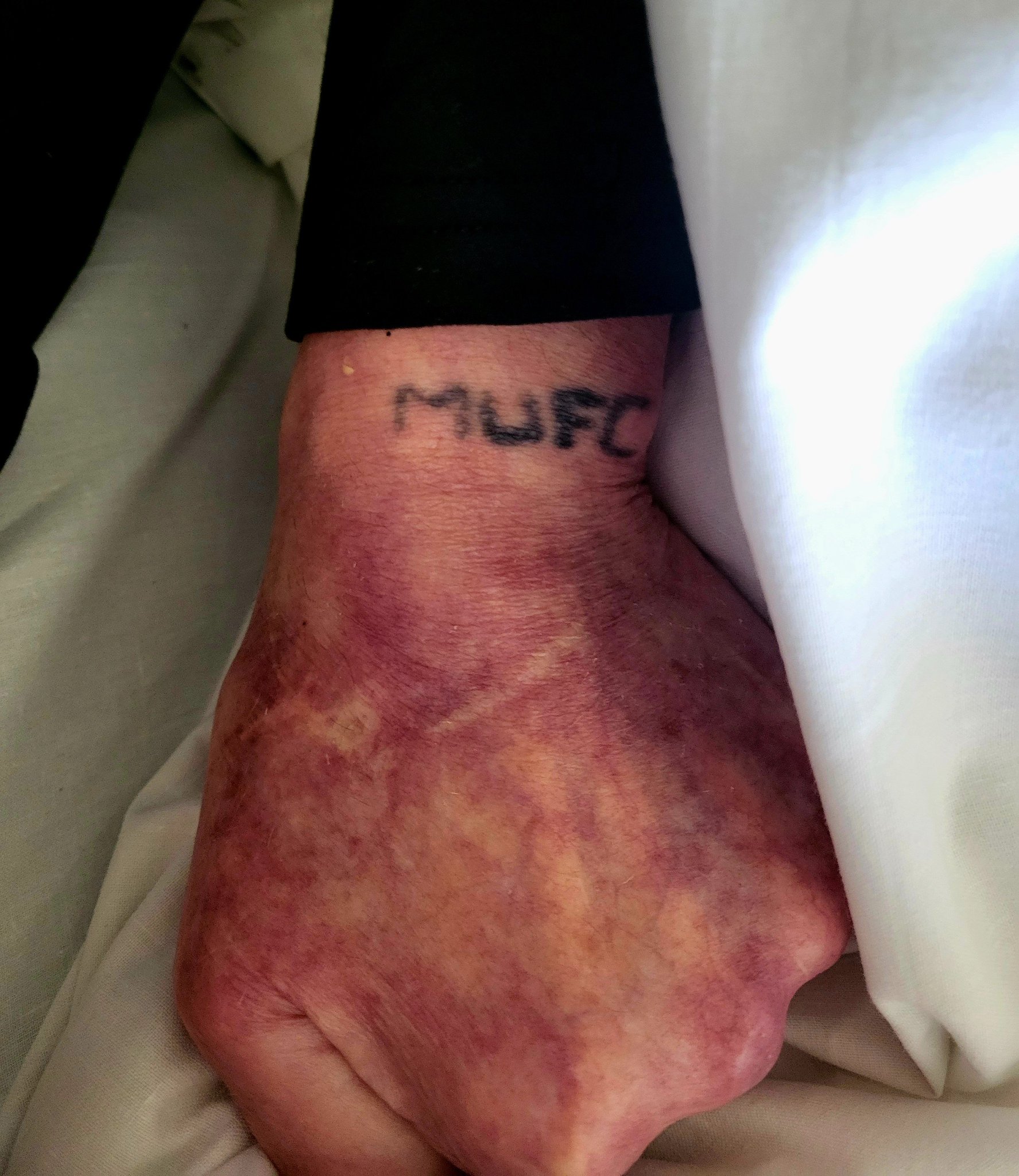 Gerry Deakin on Twitter: "Chances are this will be the last Man Utd game I get to watch with my ...