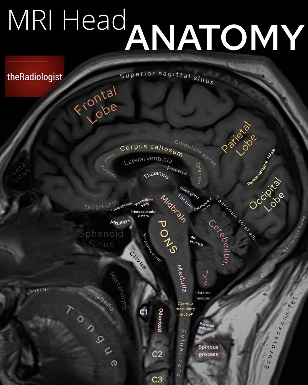 Cerebellum Anatomy Mri