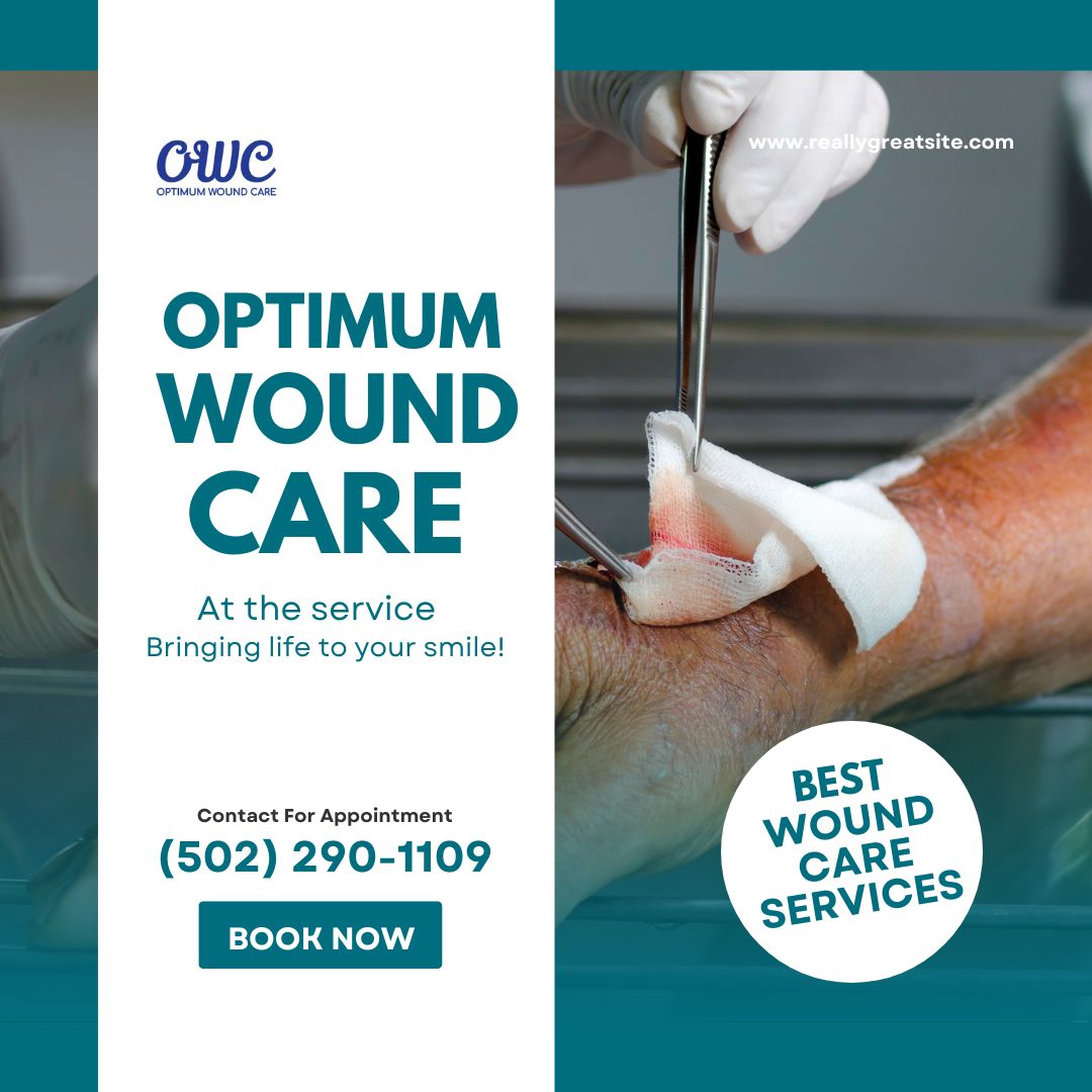 Optimum Wound Care on Twitter: "BOOK NOW! 👩‍⚕️ https://t.co/DkfUH9kPKm 📢 Optimum Wound Care (OWC ...