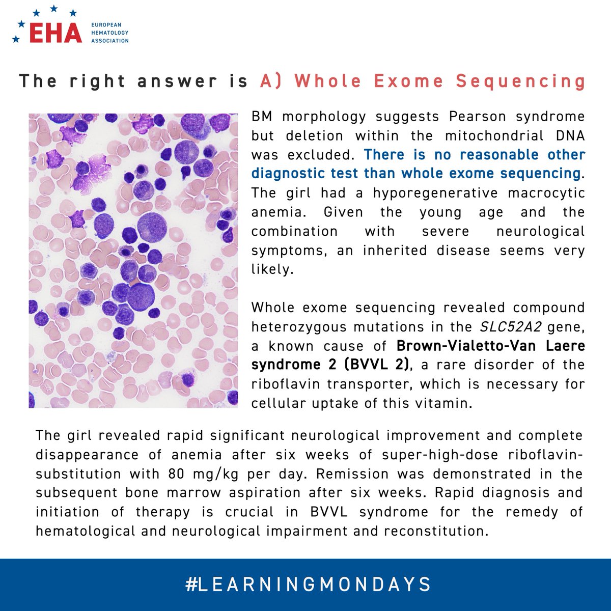European Hematology Association on Twitter: European Hematology Association on Twitter: