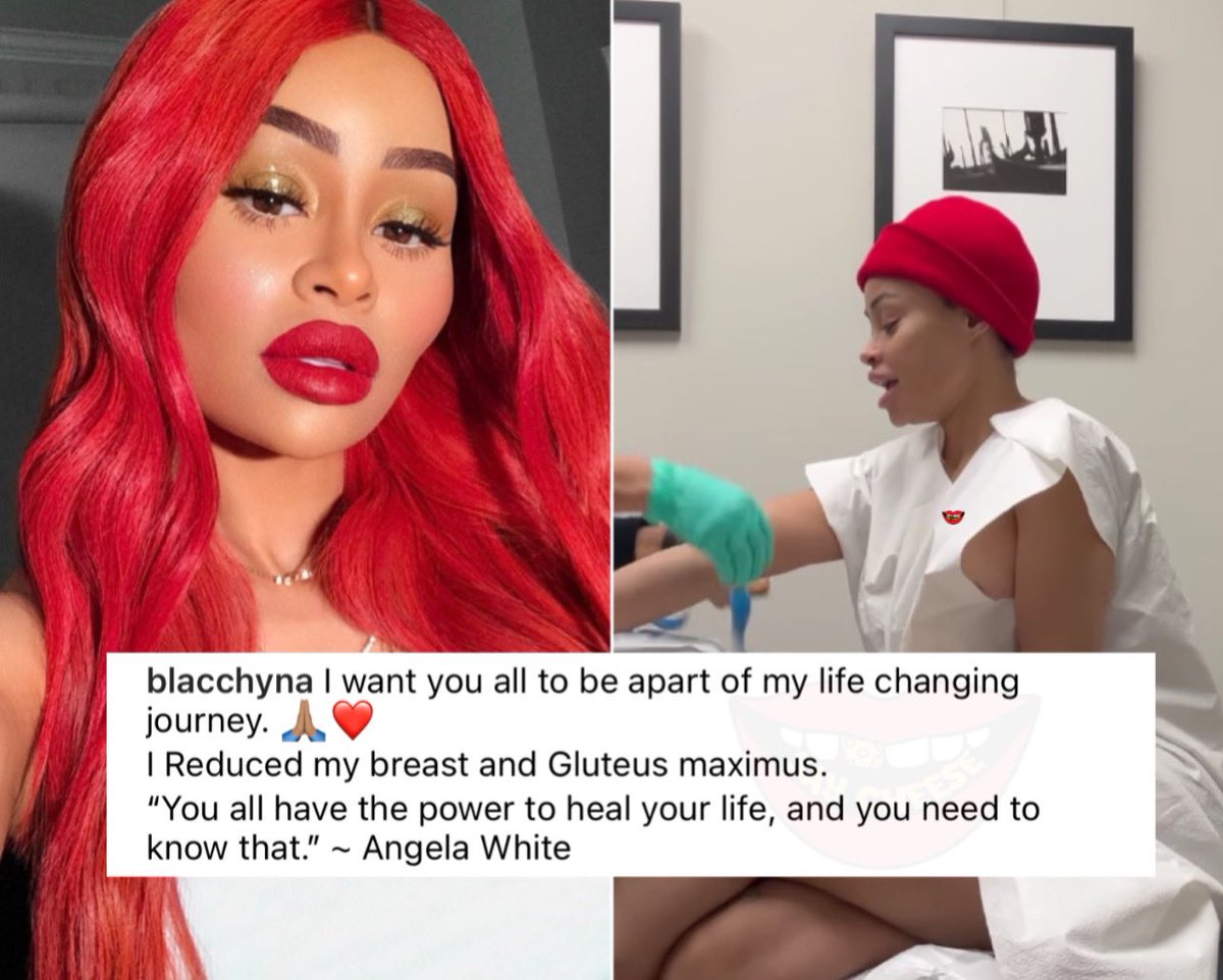 Say Cheese ππ§ On Twitter Blac Chyna Revealed That She Recently Had