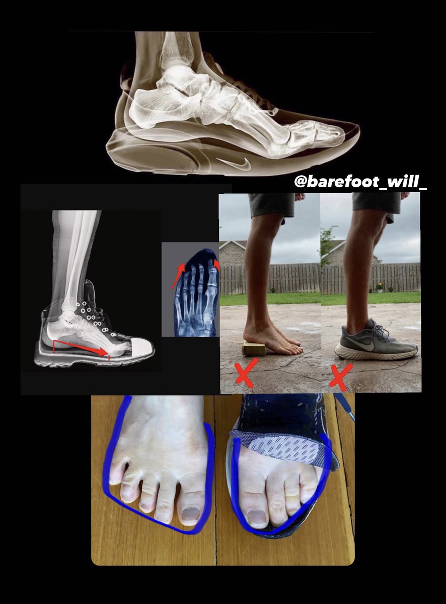 Fascia encases your entire body ONE continuous system, without a ...