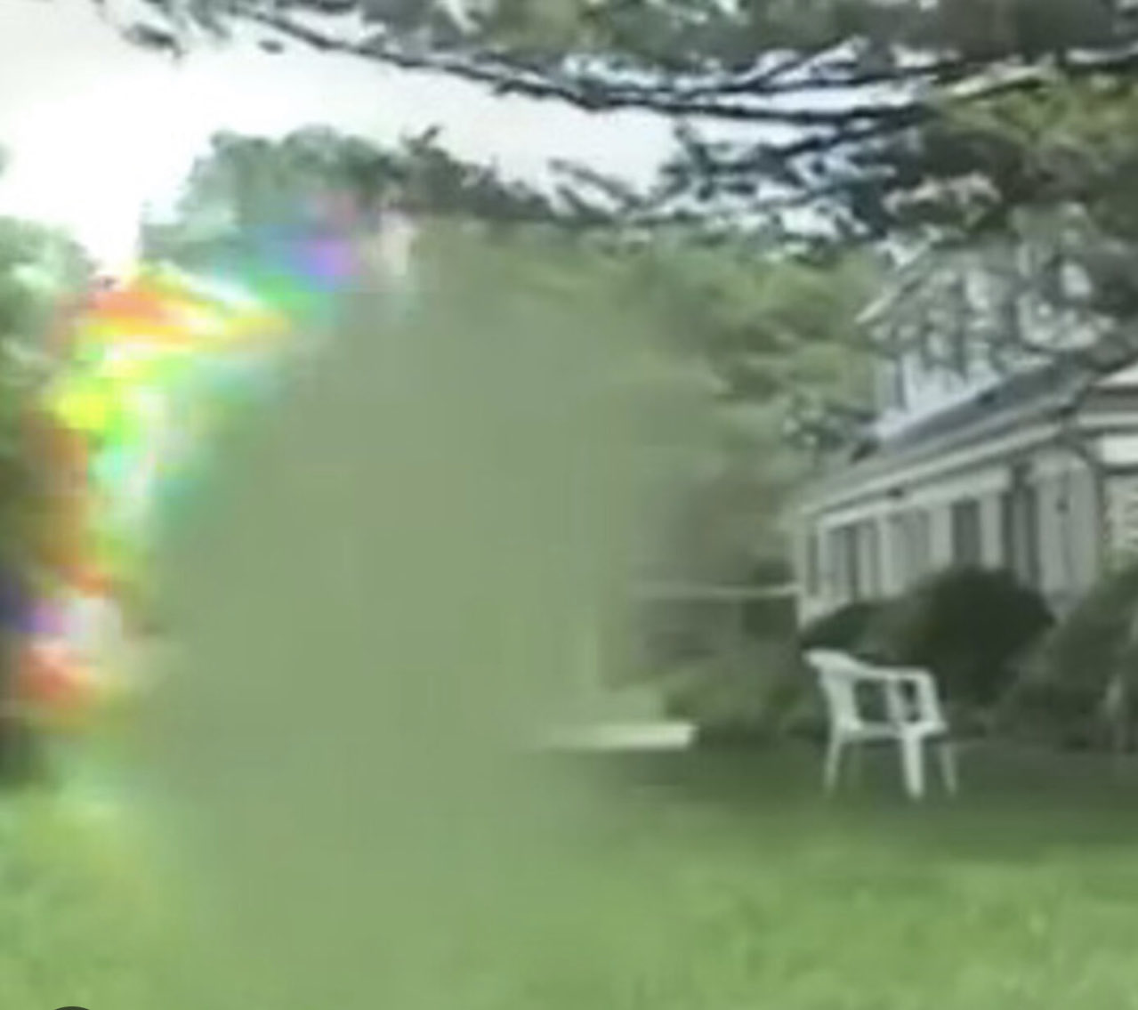 Migraine Aura Visual Migraine Aura Visual