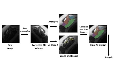 Radiology: Artificial Intelligence on Twitter: "#AI model for 3D segmentation of rotator cuff ...