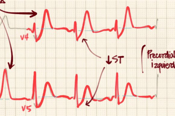 La Wiphala de Osler 🇵🇪 on Twitter: "RT @chuletadeosler: Aunque no hay elevacion del st, esto ...
