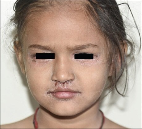 Born With No Mouth