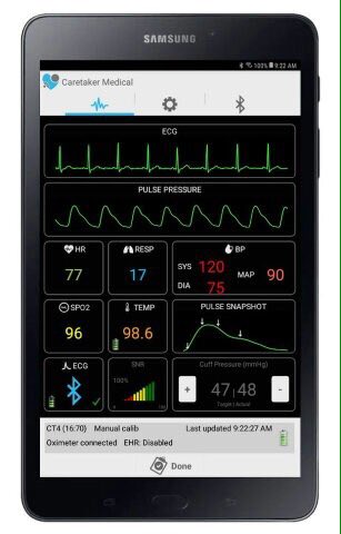 バイタルストリーム on Twitter: "Auto-detecting P-wave Arterial Fibrillation by Labtech wavelet algorithm ...