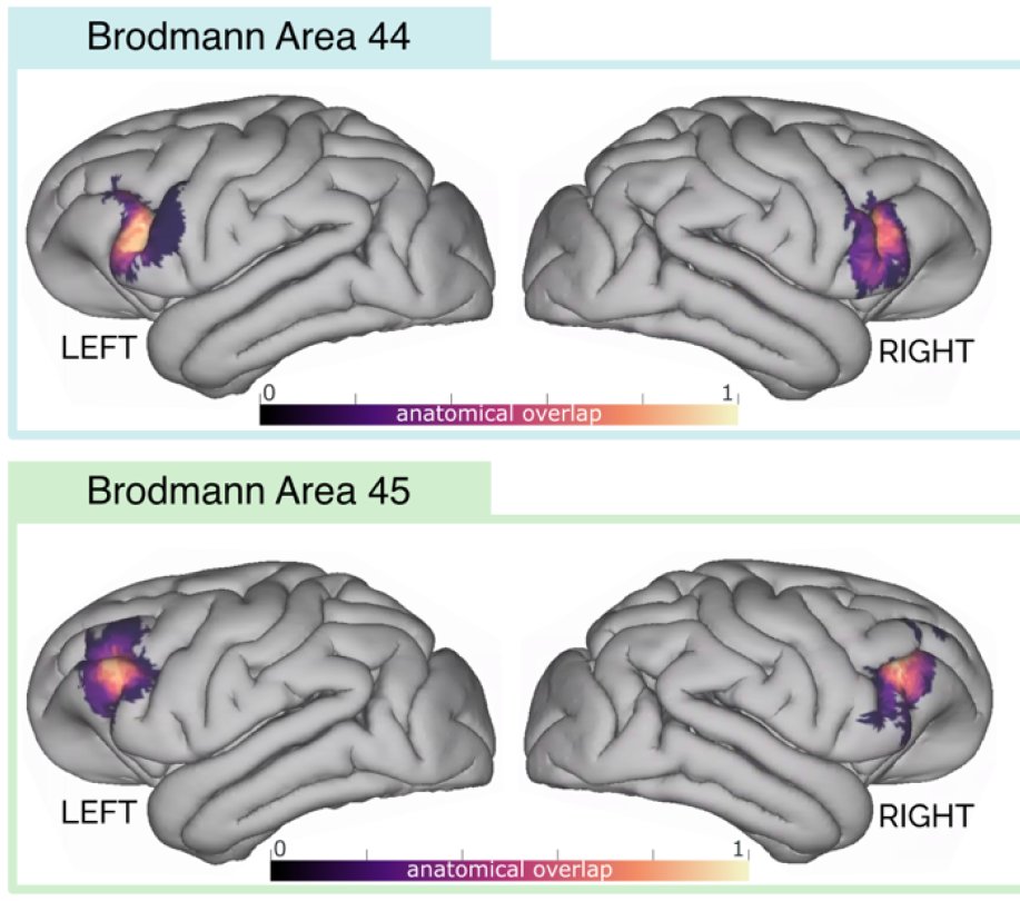 Brodmann Area 45
