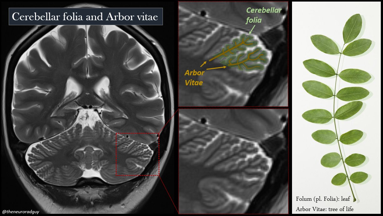 Arvore Vitae Cerebelo Nubia Watu On X: "Cerebellum Arbor Vitae Tree
