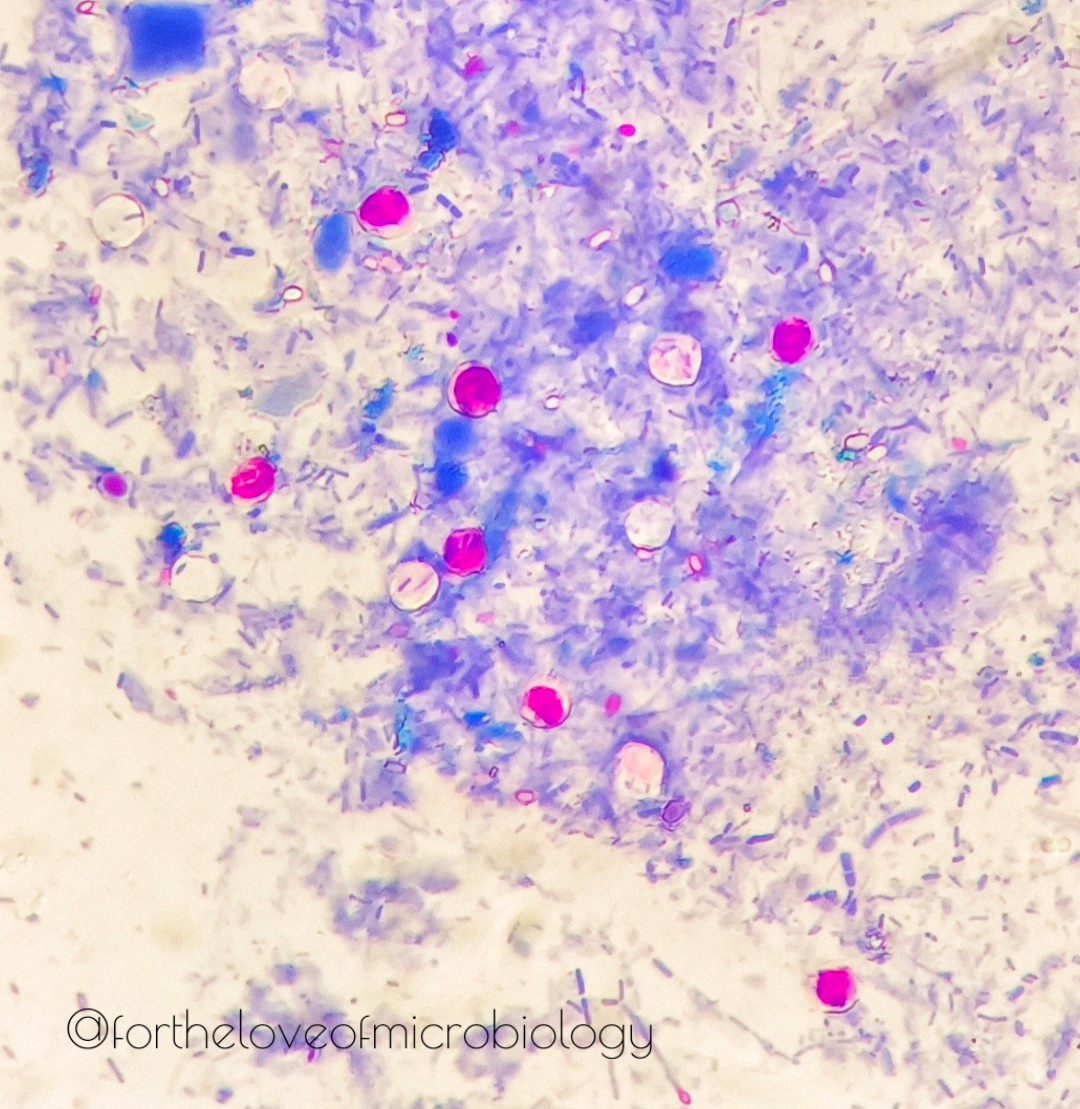 Cryptosporidium Parvum Acid Fast Stain