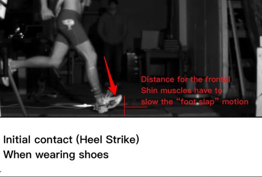 7 chronic injuries caused by the shoes on your feet (explained) 1 ...