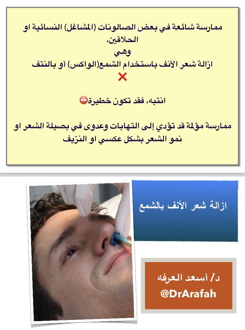 د أسعـد العرفـه 🇸🇦 On Twitter Rt Drarafah انتبـــــــه 🚨 إزالة شعر الأنف قد تكون