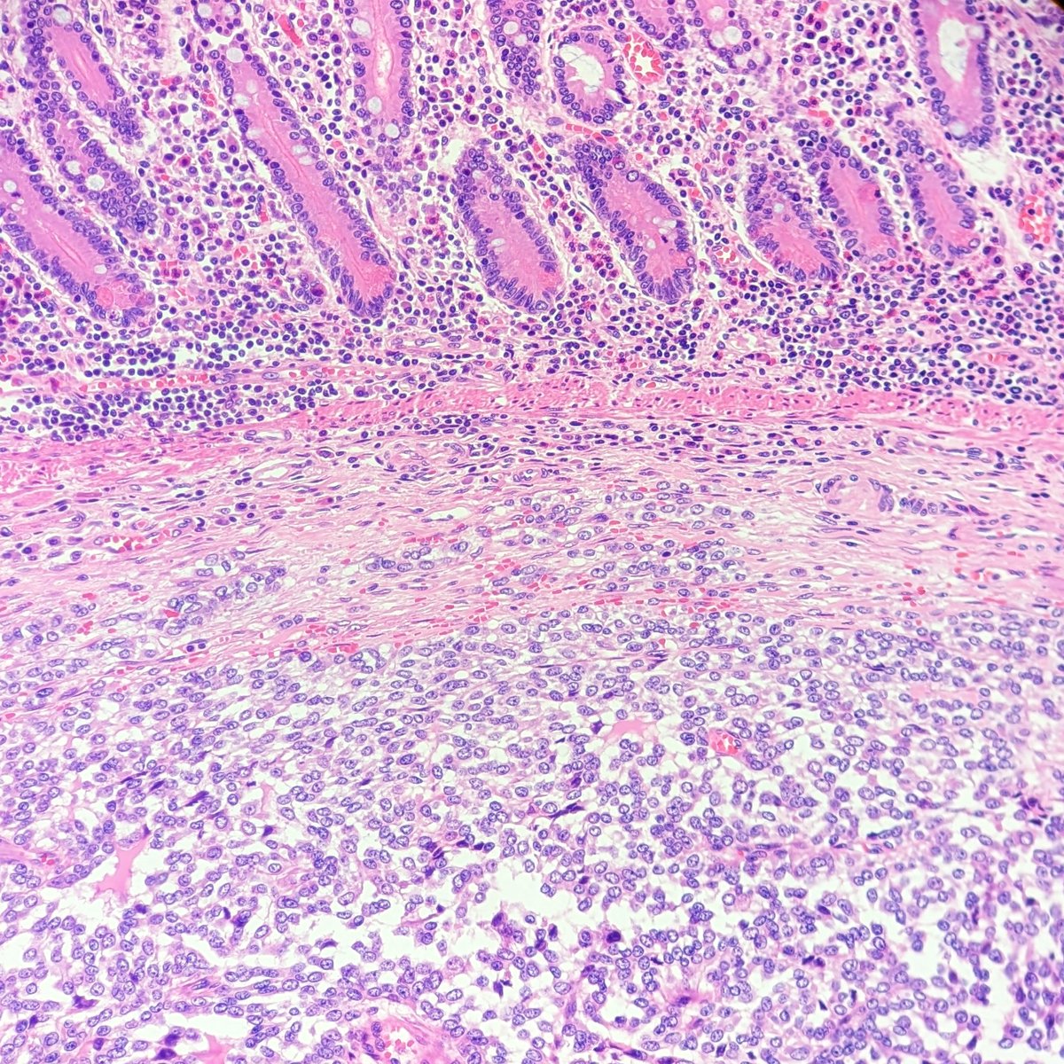Jerad Gardner, MD on Twitter: Jerad Gardner, MD on Twitter:
