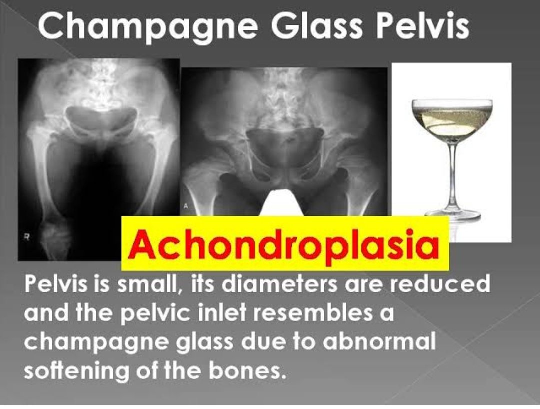 What is this sign? Seen in which condition? - Thread from Sthanu ...