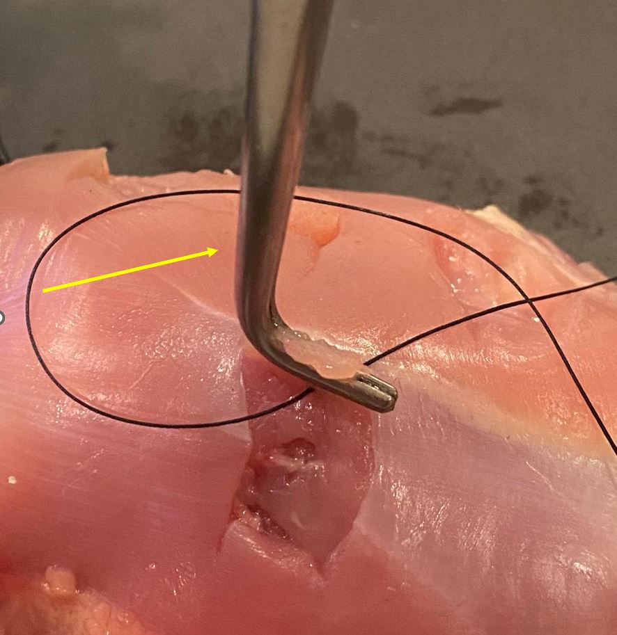 🧵regarding the 'suture ligature' or 'stick tie', or whatever you call ...