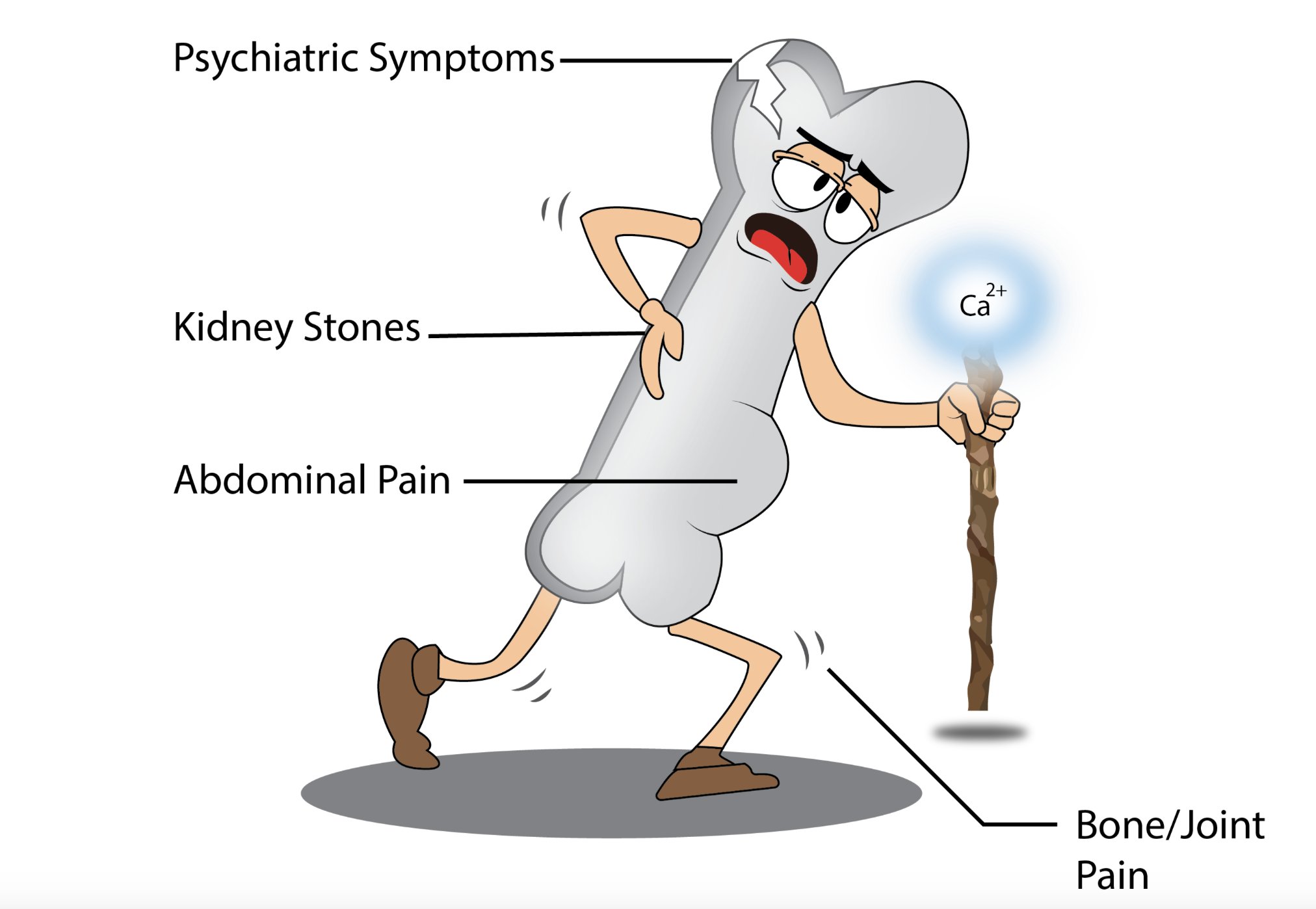Hypercalcemia Symptoms And Signs
