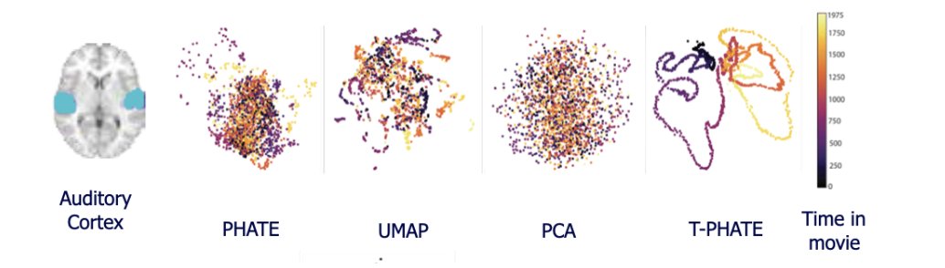 Krishnaswamy Lab on Twitter: "(3/n) Here, we show T-PHATE embeddings of a participant’s brain ...