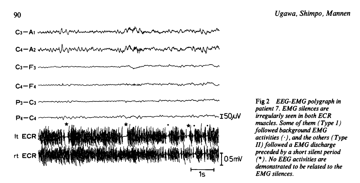 SEIZURE SEMIOLOGY TWEETORIAL #Epilepsy #Seizure #Neurotwitter 🧵/1 What ...