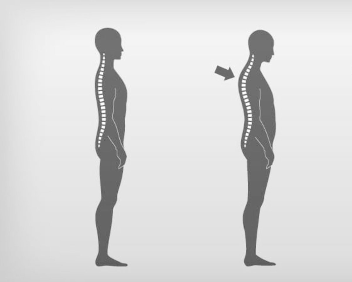 FIX POOR POSTURE The epidemic of sedentary lifestyles is causing our ...