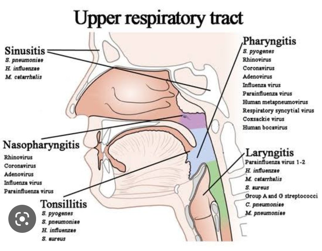 Common Cold Diagram