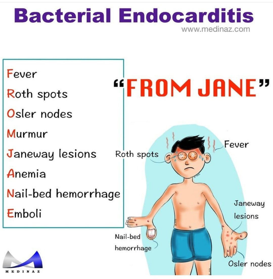 Bacterial Endocarditis Osler Nodes