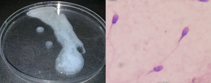 TATOZO LA SHAHAWA NYEPESI NA IDADI NDOGO YA MANII "LOW SPERM COUNT ...