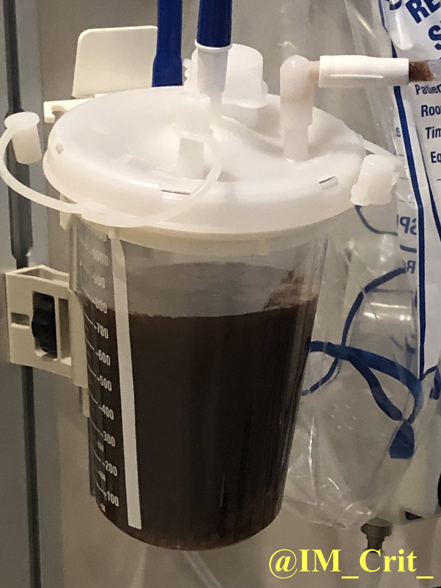 ICU stories: Diabetic ketoacidosis (DKA) is another "bread-and-butter ...