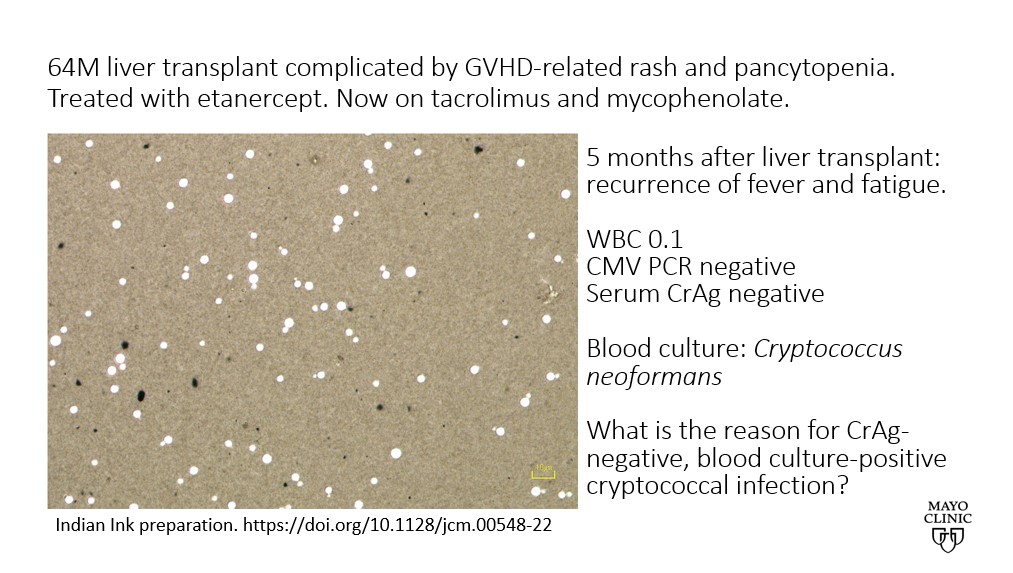 Images of Infectious Diseases #MayoIDCase 5 months after liver ...