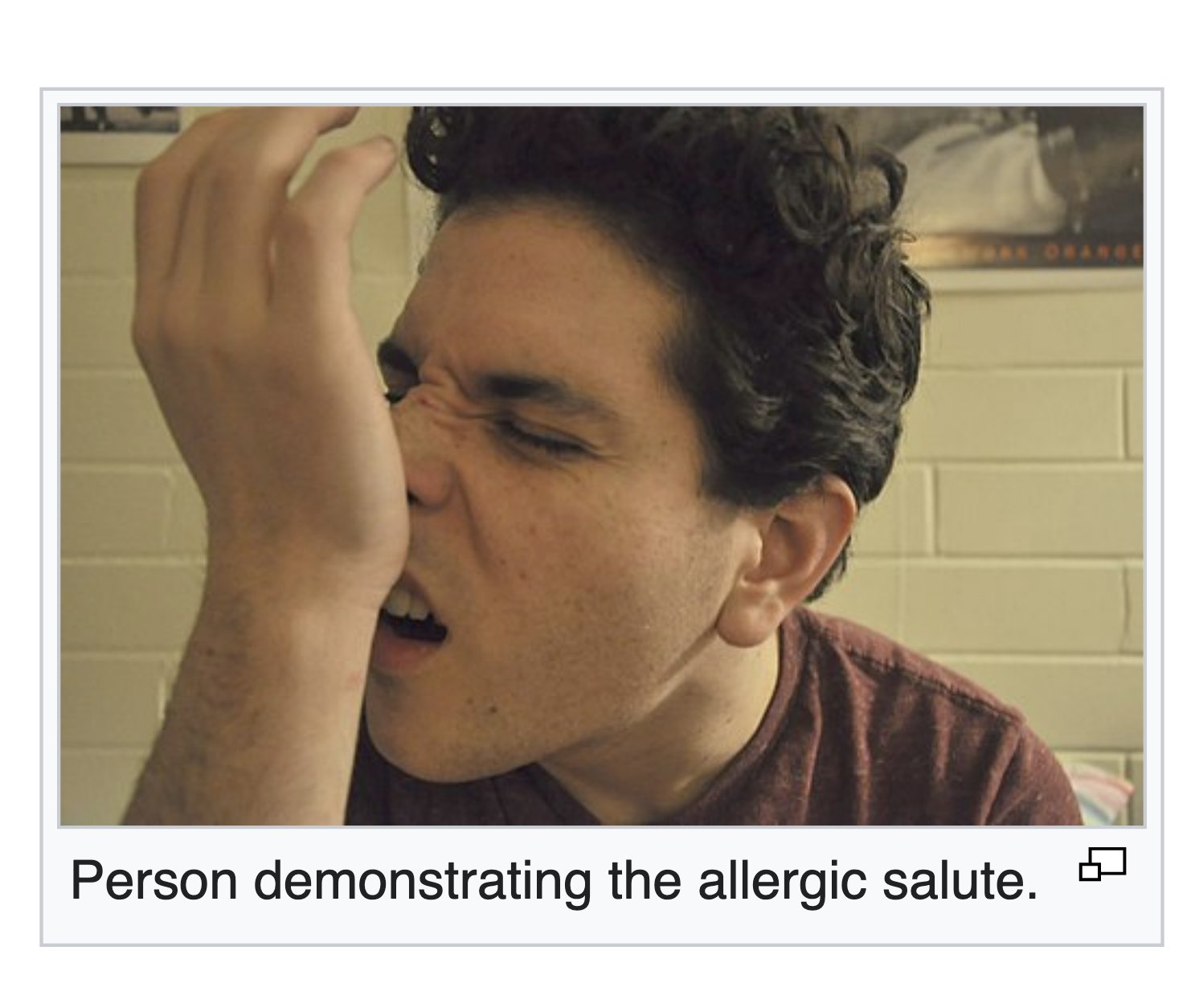 Allergic Salute