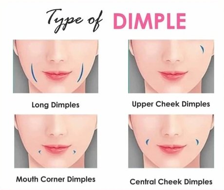 Types Of Dimples