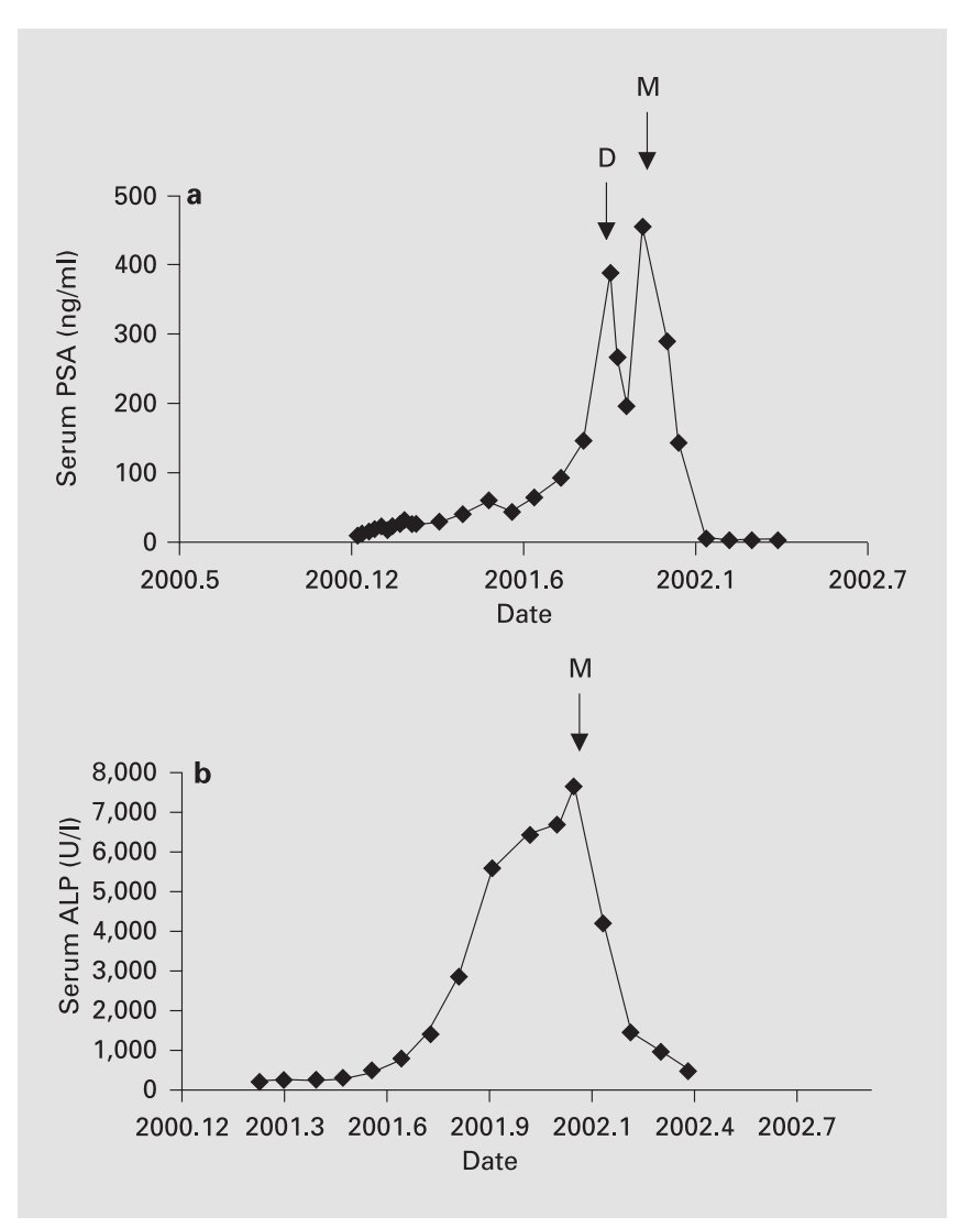 Three amazing cases of tumour regression with the use of Phellinus ...